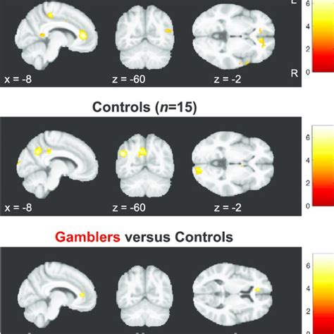Color Coded Statistical T Score Maps Brain Regions Showing A Positive Download Scientific