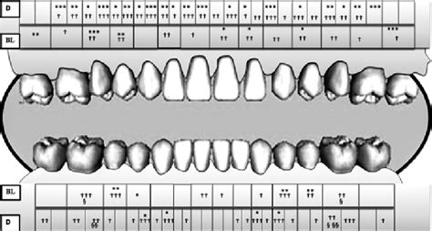 Maxillary And Mandibular A Arch Width B Arch Download Scientific