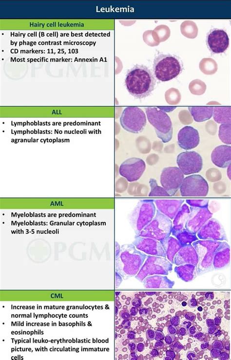 Leukemia Technology Lab Medical Technology Medical Science Science