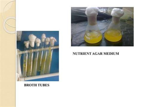 Isolation Of Protease Producing Microorganism Pptx Gardening Home And Garden