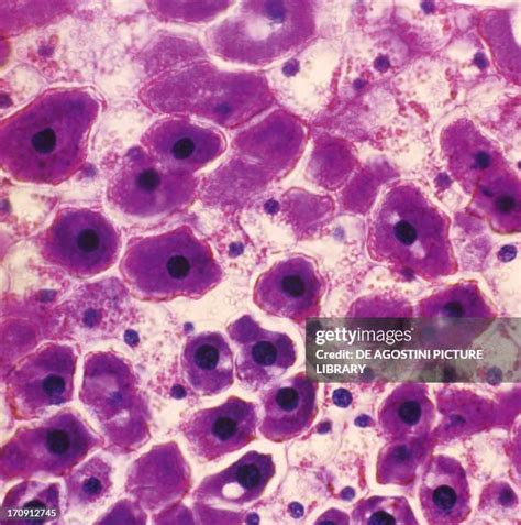Rhizobium Bacteria Photos And Premium High Res Pictures Getty Images