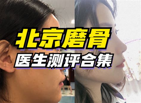 北京磨骨医生有哪些？北京下颌角磨骨医生测评（何照华、张笑天、黄大勇、靳小雷、邵祯、张智勇、张立天） 知乎