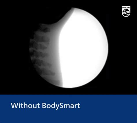 [video] Wouter Van Spronsen On Linkedin Get A Clear Vision Of Anatomical Structures In