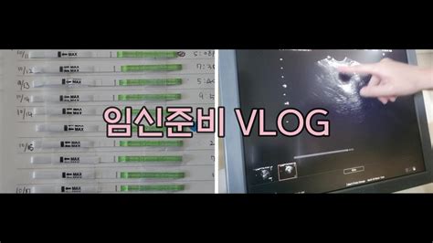임신준비 Vlog 배란초음파 캠핑 편한 일상이야기 4 Youtube