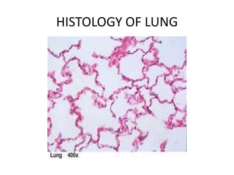 31 Pulmonary Embolism And Infarctionpptx