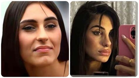 Gabriela Di Temptation Island Si è Rifatta Sui Social Mostra Il Prima