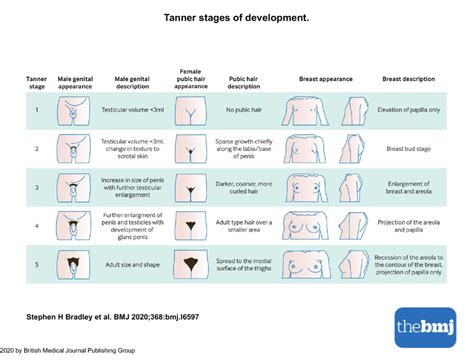 Delayed Puberty Mind The Bleep