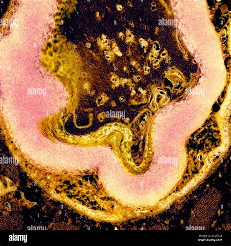 Myelinated Nerve Coloured Transmission Electron Micrograph Tem Of A