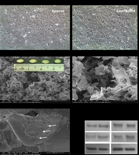 Morphological Differences Of Chondrocytes Cultured In 2d And 3d Systems