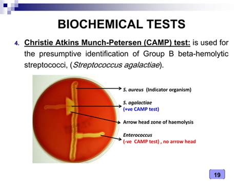 Medical Microbiology Laboratory Streptococcus Spp