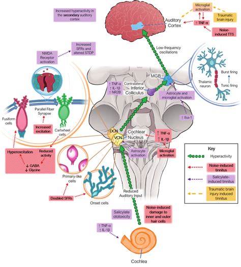 The Current Neuroinflammatory Model Of Tinnitus In The Context Of The Download Scientific