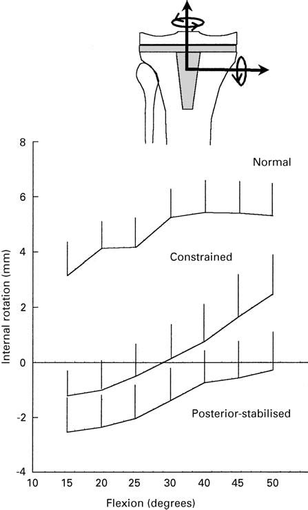 Internal External Rotation Of The Tibia With A Fixed Femur Download Scientific Diagram