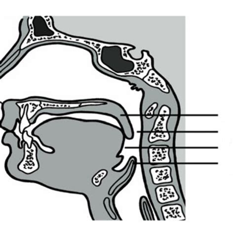 Corresponding Positions Of The Vote Classification In The Upper Airway