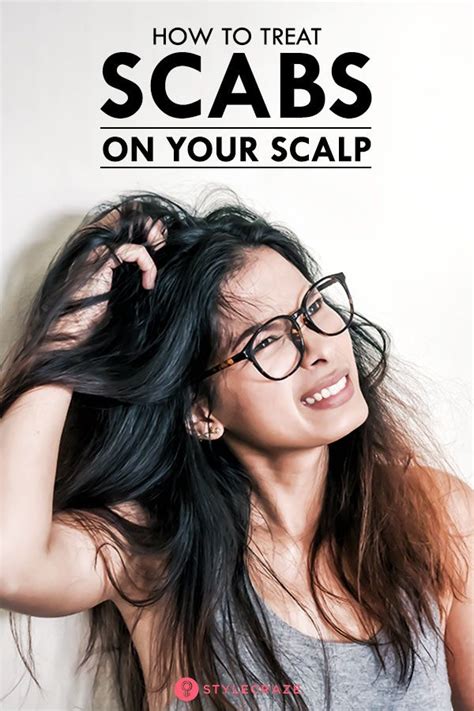 How To Treat Scabs On The Scalp Artofit
