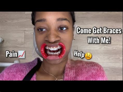 Braces Vlog Come Get Braces With Me YouTube