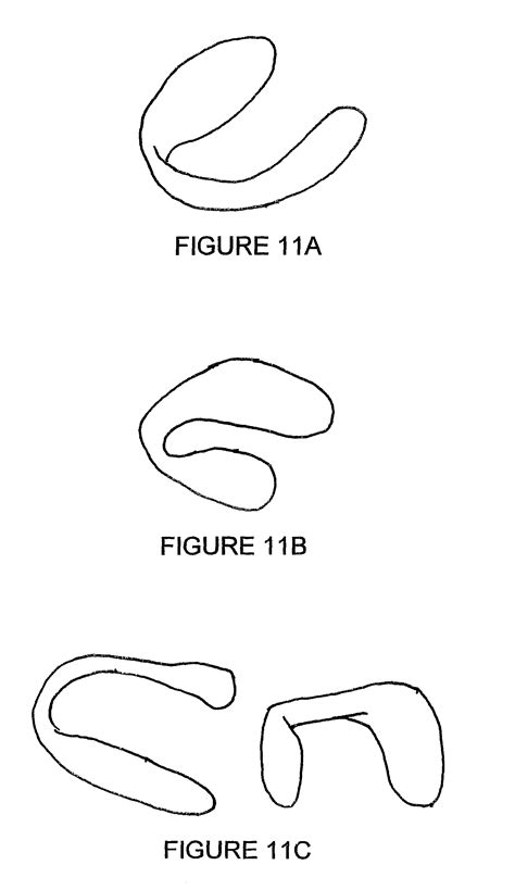 Patent US7931605 Electro Mechanical Sexual Stimulation Device To Be Worn During Intercourse