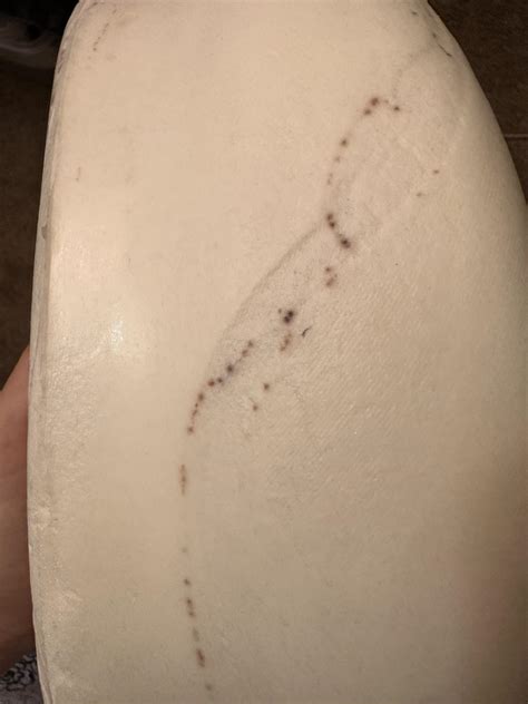 Is This Mold On A Memory Foam Pillow Rmold