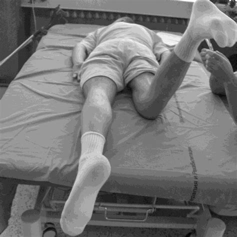 Knee Flexion With Lateral Deviation Of The Tibia Download Scientific Diagram