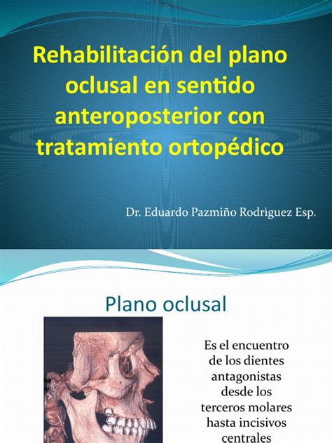 Rehabilitación Oclusal Anteroposterior Pdf