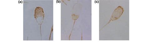 Location Of Dna Binding To Intact Spermatozoa Evaluation By Download Scientific Diagram