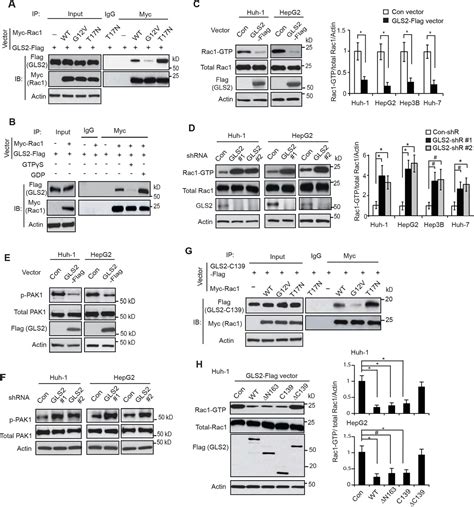 Figures And Data In Glutaminase Is A Novel Negative Regulator Of
