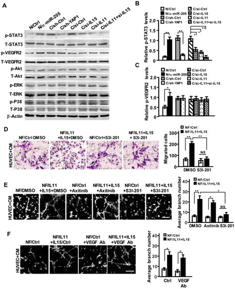 Mir 205 Yap1 In Activated Fibroblasts Of Breast Tumor Promotes Vegf Independent Angiogenesis