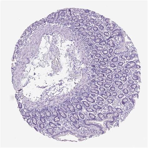 Tissue Expression Of Satb2 Staining In Duodenum The Human Protein Atlas