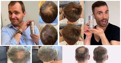 How To Hide Hair Loss At The Crown With Pictures Nut Job Hair