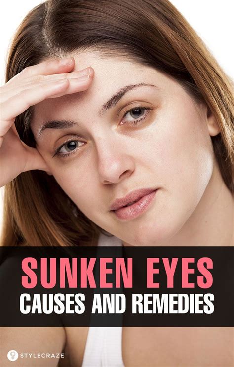 Sunken Eyes Artofit
