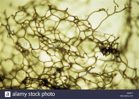 Kitchen Sponge Under Microscope At Aileen Dill Blog
