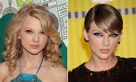 Taylor Swift Before And After Implants