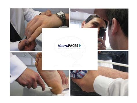 Neurology Mrcp Paces Courses