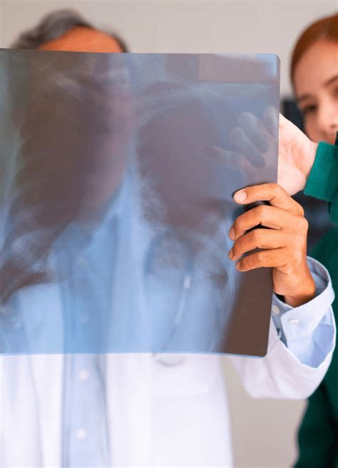 CURSO FISIOTERAPIA RESPIRATÓRIA RECIFE ESCOLA DOUTORES Escola Doutores
