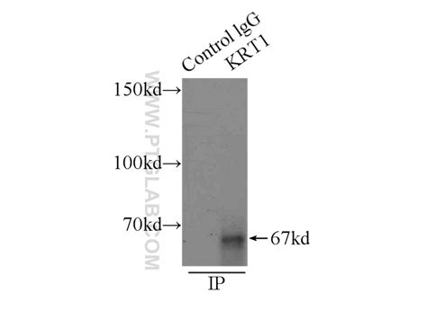 Cytokeratin 1 Specific Antibody 16848 1 Ap Proteintech 武汉三鹰生物技术有限公司