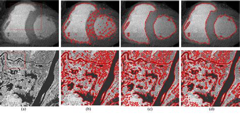 Figure 1 From A Novel Active Contour Model Guided By Global And Local