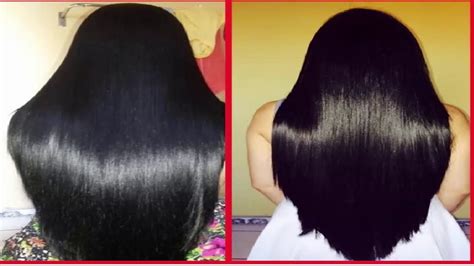 How To Make Your Hair Grow Faster Home Remedies That Work Wonders Youtube