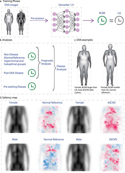 A Deep Learning Sex Specific Body Composition Ageing Biomarker Using