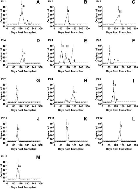 Serial Analysis Of Ebv Loads In Patients With High Level Ebv