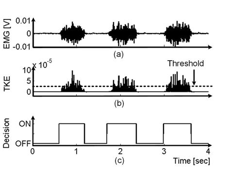 Detection Algorithm With N 80 A Emg Signal From Forearm Flexor B