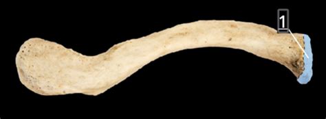 Scapula Clavicle Flashcards Quizlet