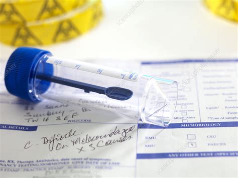 Clostridioides Difficile Test Stock Image M874 0714 Science Photo Library