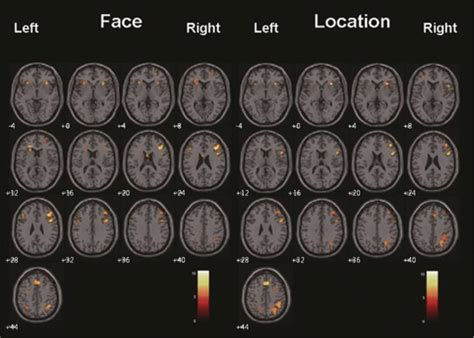 Activation Maps For The Face Matching Working Memory Task Left And