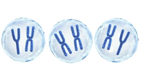 Letter Chromosomes Determine Sex Not Gender Surgery • Eagle Forum