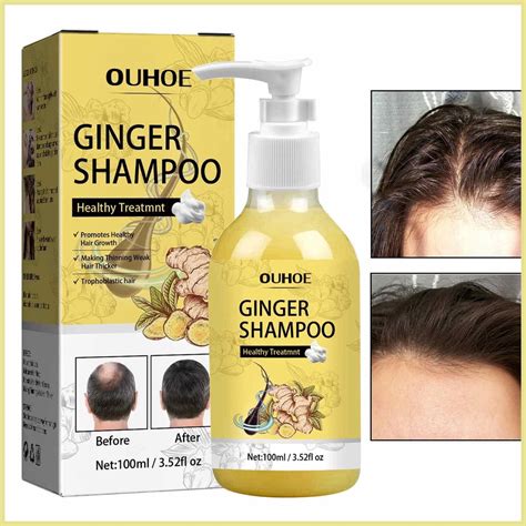 Ginger Scalp Care Shampoo Natural Ginger Shampoos For Scalp Problems