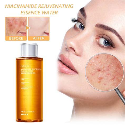 Fiudx Liquidación De Ofertas Flash Tónico Hidratante Exfoliación