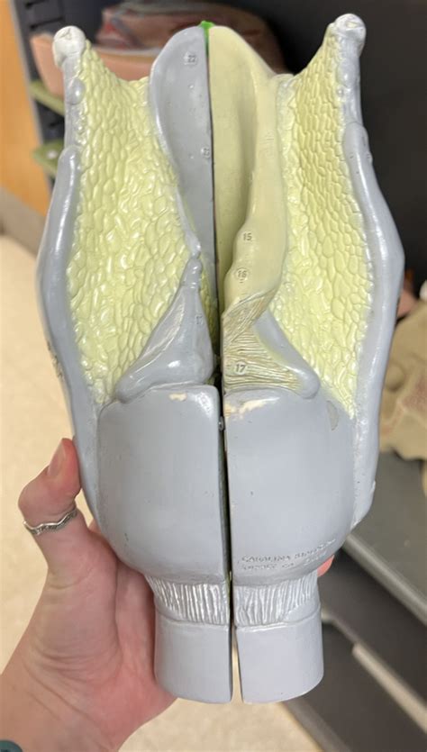 Posterior Trachea Diagram Quizlet