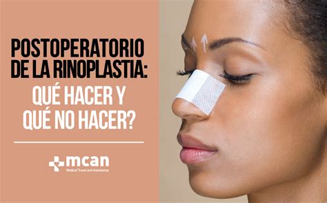 Postoperatorio de la Rinoplastia Qué Hacer y Qué No Hacer
