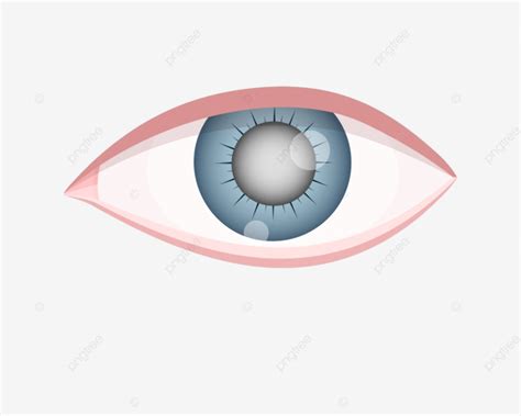 Cataract Eye Close Up View Up Illustration Senior Png And Vector