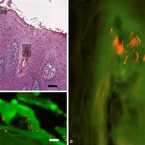 Pdf Experimental Infection Of Cattle With Ovine Dichelobacter Nodosus Isolates