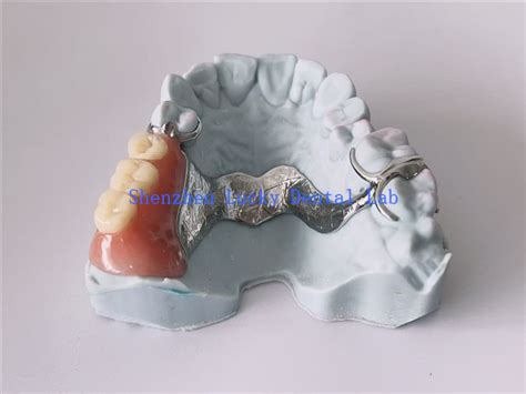 China Dental Cocr Metal Framework With Double Aker Clasp Dental Lab Manufacturers Suppliers Factory